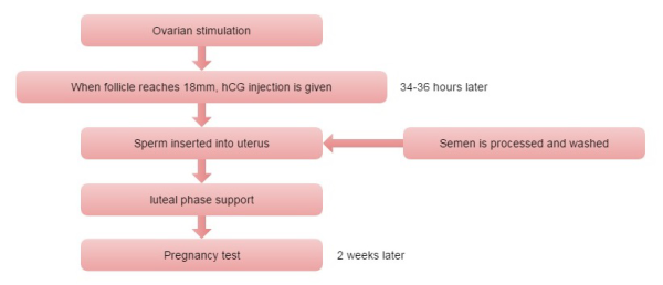 Intrauterine Insemination (IUI) - Metro IVF Fertility Centre