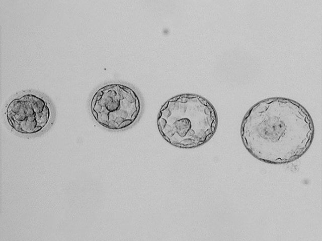 Blastocyst Culture - Metro IVF Fertility Centre