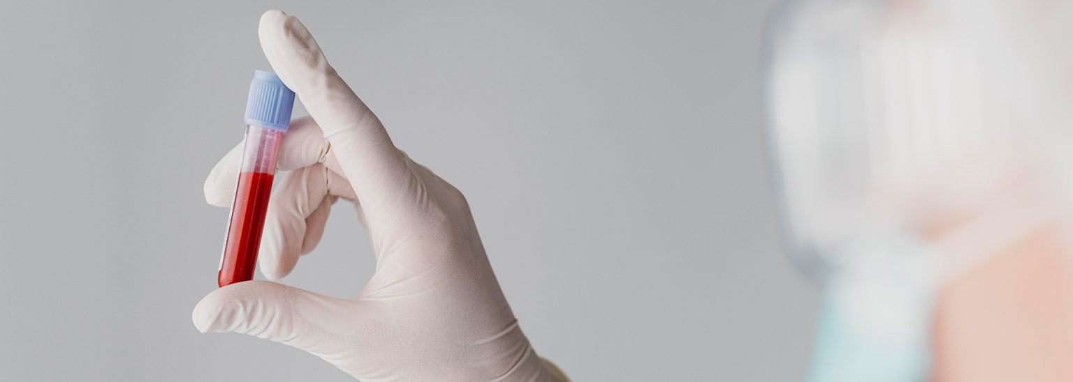 Blood Test - Metro IVF Fertility Centre
